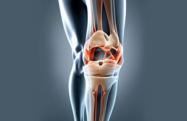  ACL Injury 