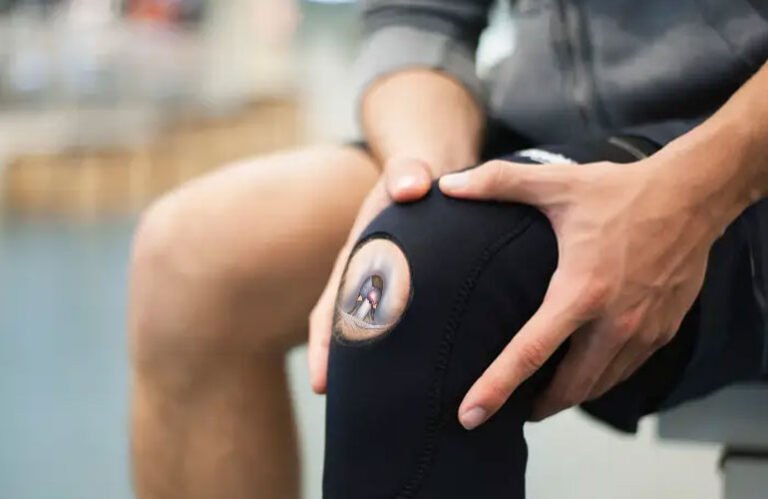 Chronic ACL Injury & Its Cause, Symptom & Treatment