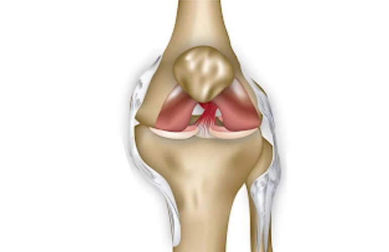 Don t You Suffer By Grade 1 ACL Injury Don t You Suffer By Grade 1 ACL Injury