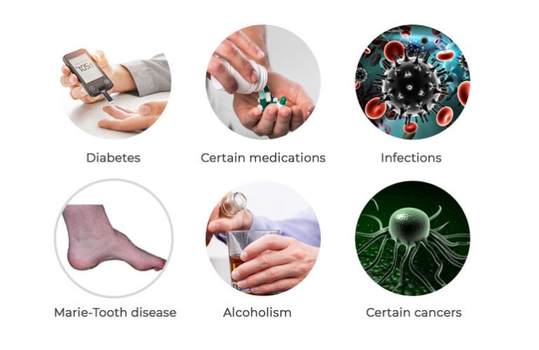 Autonomic Neuropathy