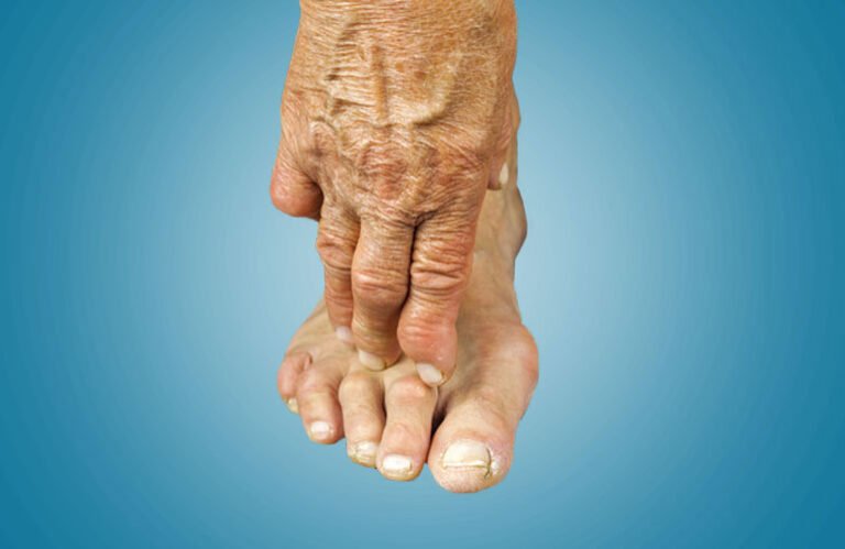 Radiating Pain Explained: What Causes It and How to Treat It | ASPC ...