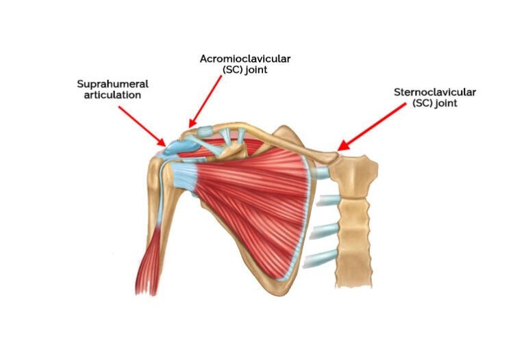 How Frozen Shoulder Pain Radiate to Back and Chest? | ASPC Manipulation ...