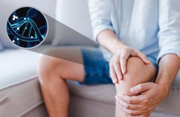 Joint disorders - Exploring the Genetic Links to Osteoarthritis ...